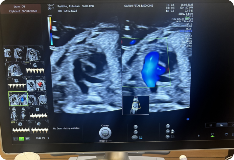 Fetal Echo Test in Chandigarh | Fetal Echo Test Price in Chd