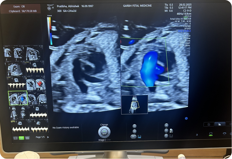 Fetal Echo Test in Chandigarh | Fetal Echo Test Price in Chd